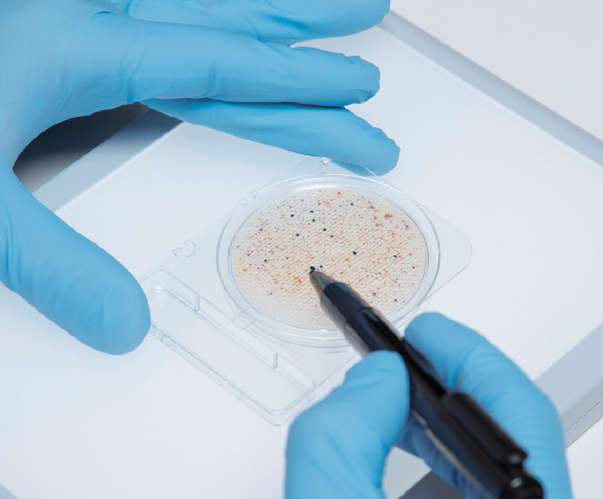 Shimadzu CompactDry™ – Metode Praktis Deteksi Mikroba pada Sampel Pangan - PT. THERMALINDO ...