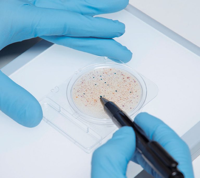 CompactDry™: Inovasi Terkini dalam Analisis Mikrobiologi - PT ...